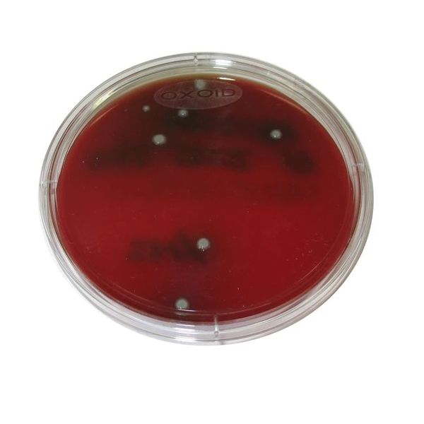 PB0225A - Fasting anaerobic agar (F.A.A.A.) with horse blood ...