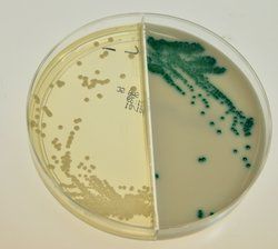 PO5258E - Brilliance Candida/Sab.Cg Selective Agar, 90 mm bi-plate, 10 ...