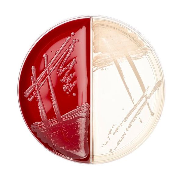 PB1155E - Brilliance™ Clarity UTI/Staph-Strep CNA (MOD)-Double Plate ...