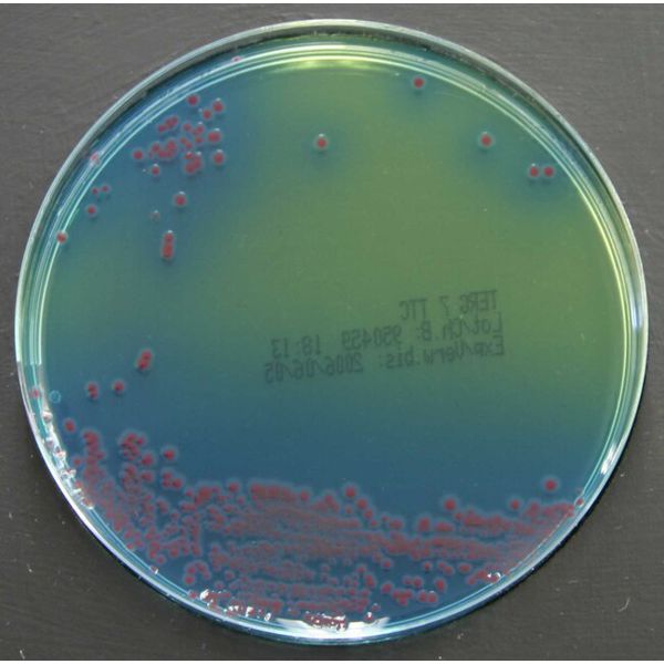 PO5411J - Tergitol 7 Lactose Ttc Agar, 55mm | Analytics-Shop