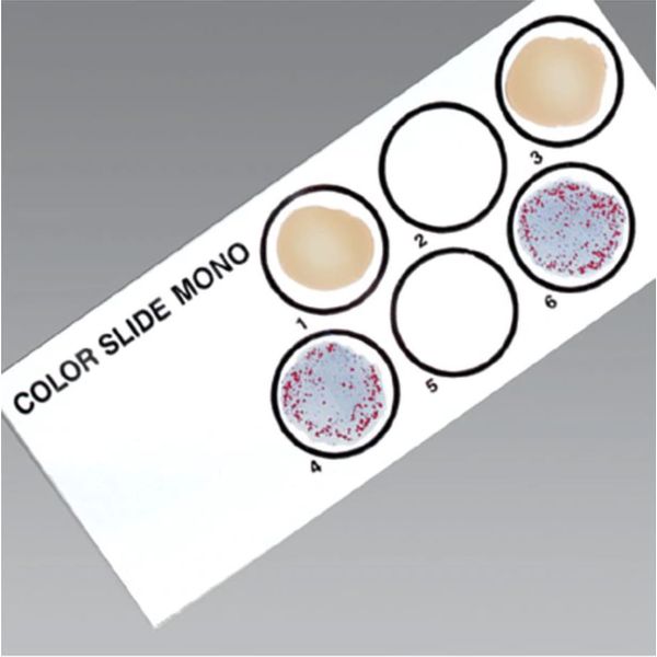 R2471088 - Remel™ Color Slide™ II Mononucleosis Test, 150 Tests ...